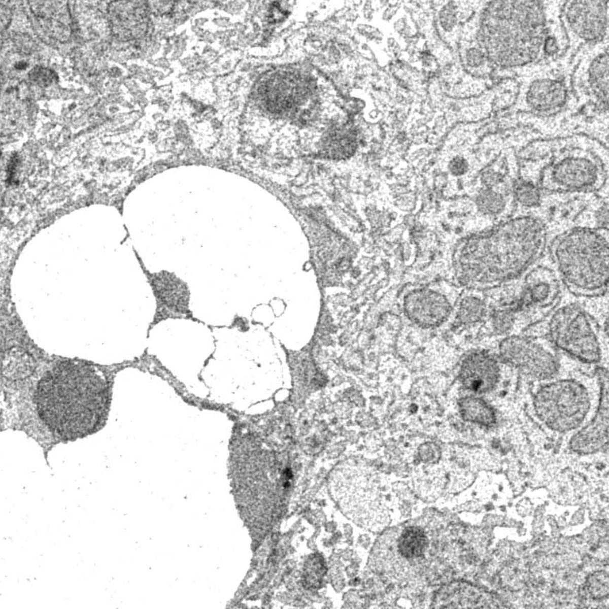 No one is talking about Etch A Cell - Fat Checker right now.
